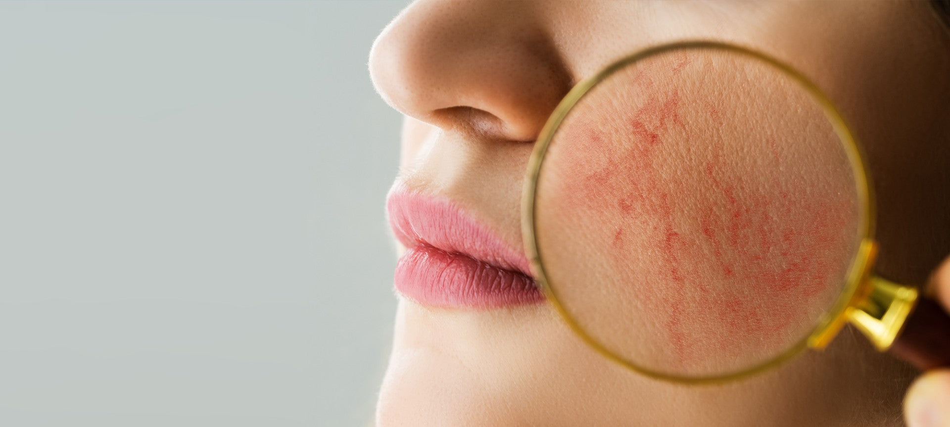 6 Dermatologist Tips to Help Treat Rosacea - and how to know if you ha