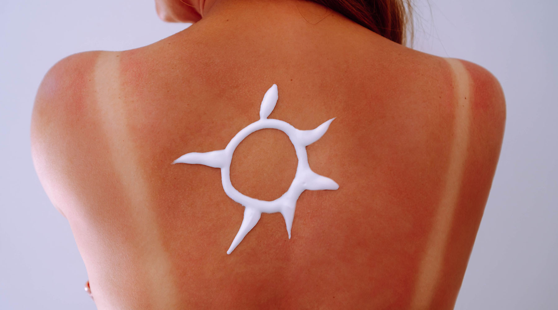 Is it possible to reverse sun damage?